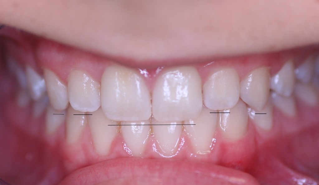 Cosmetic Dentistry Newcastle | Belle Dental