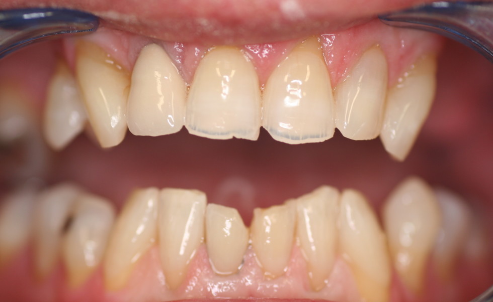 Cosmetic Dentistry Newcastle | Belle Dental