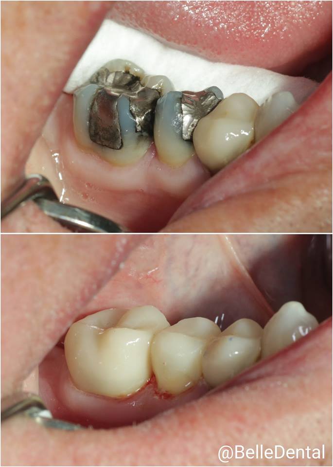 BelleDental CRC Transformation - BelleDental - July 25, 2018