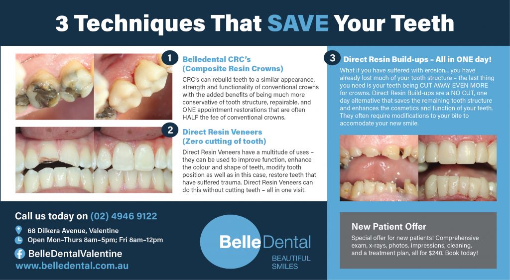 3 techniques that save your teeth!! - BelleDental - Dental Crown ...